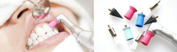 PMTC （ Professional Mechanical Tooth Cleaning）専門家による機械的な歯面清掃 | kae's ...