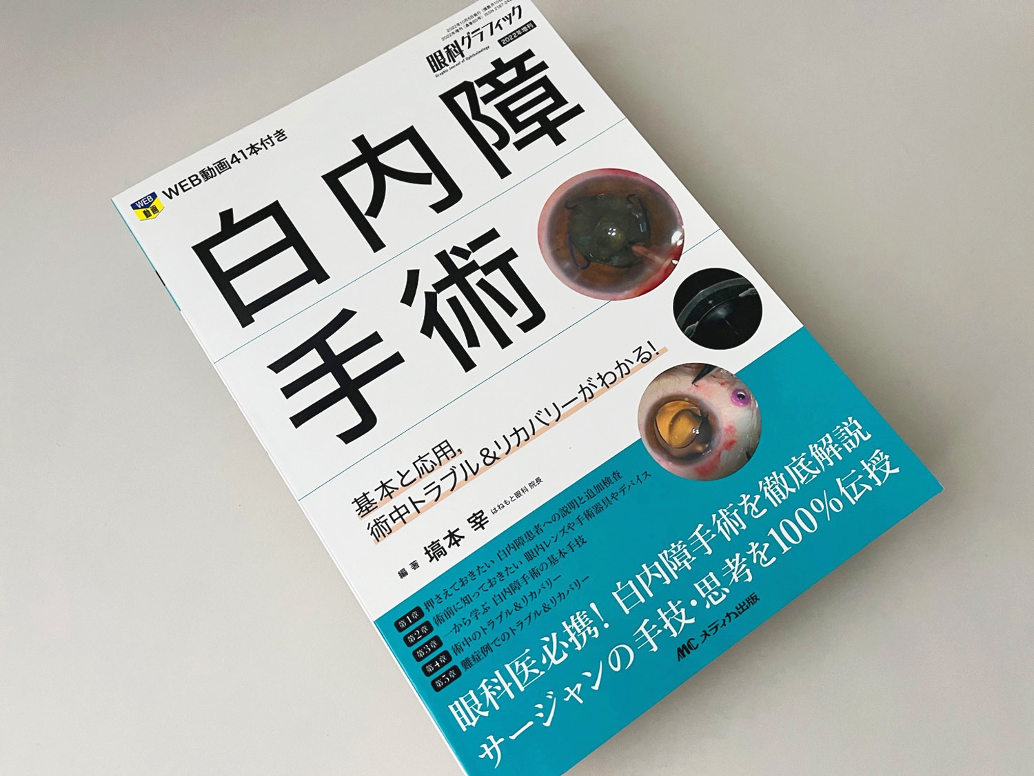 白内障手術 | TiO design