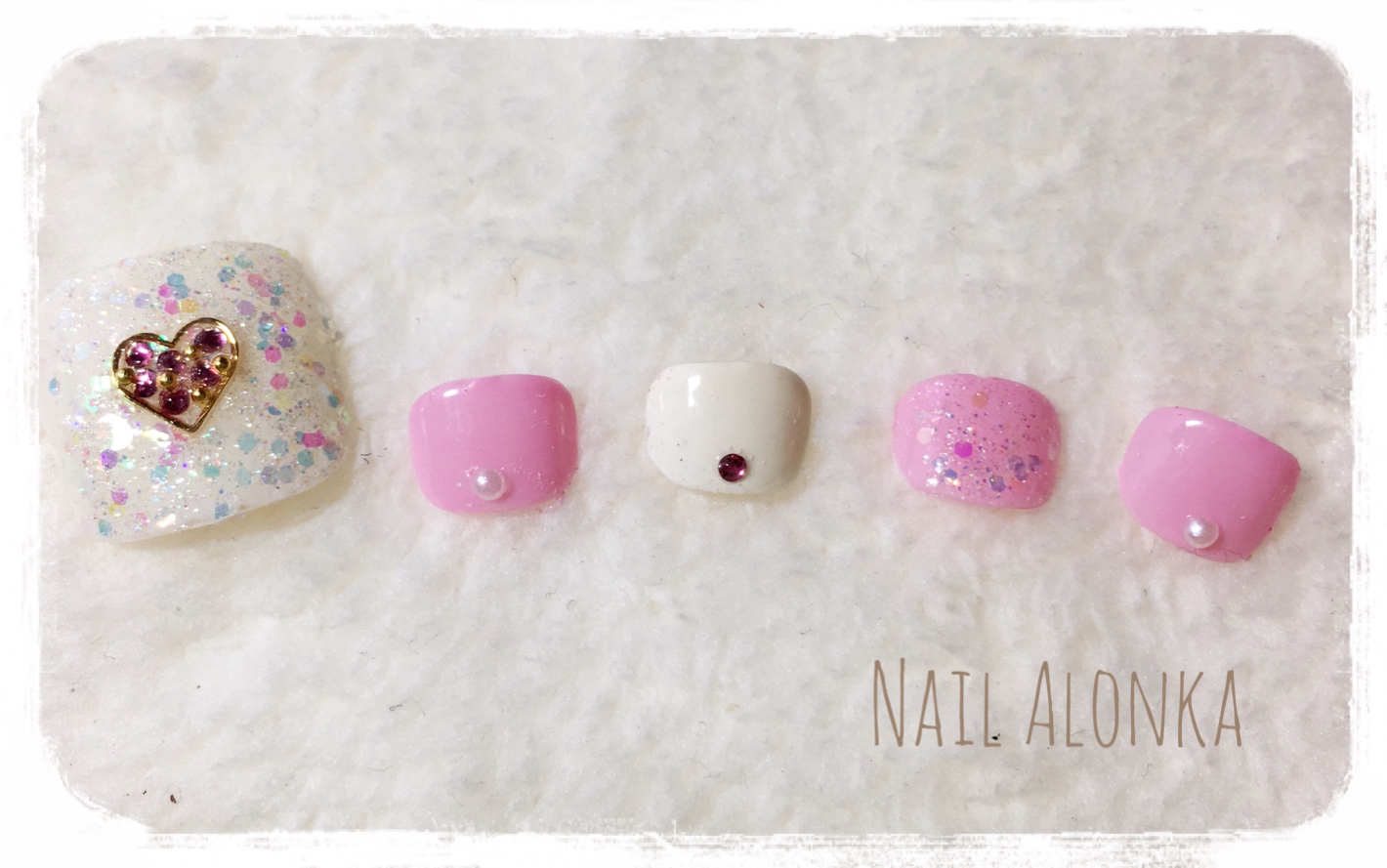 New Foot Nail | Nail Alonka
